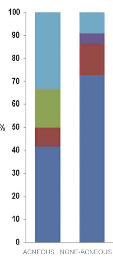 Acne bacteria, how dysbiosis bully the skin, among 4 etiological ...